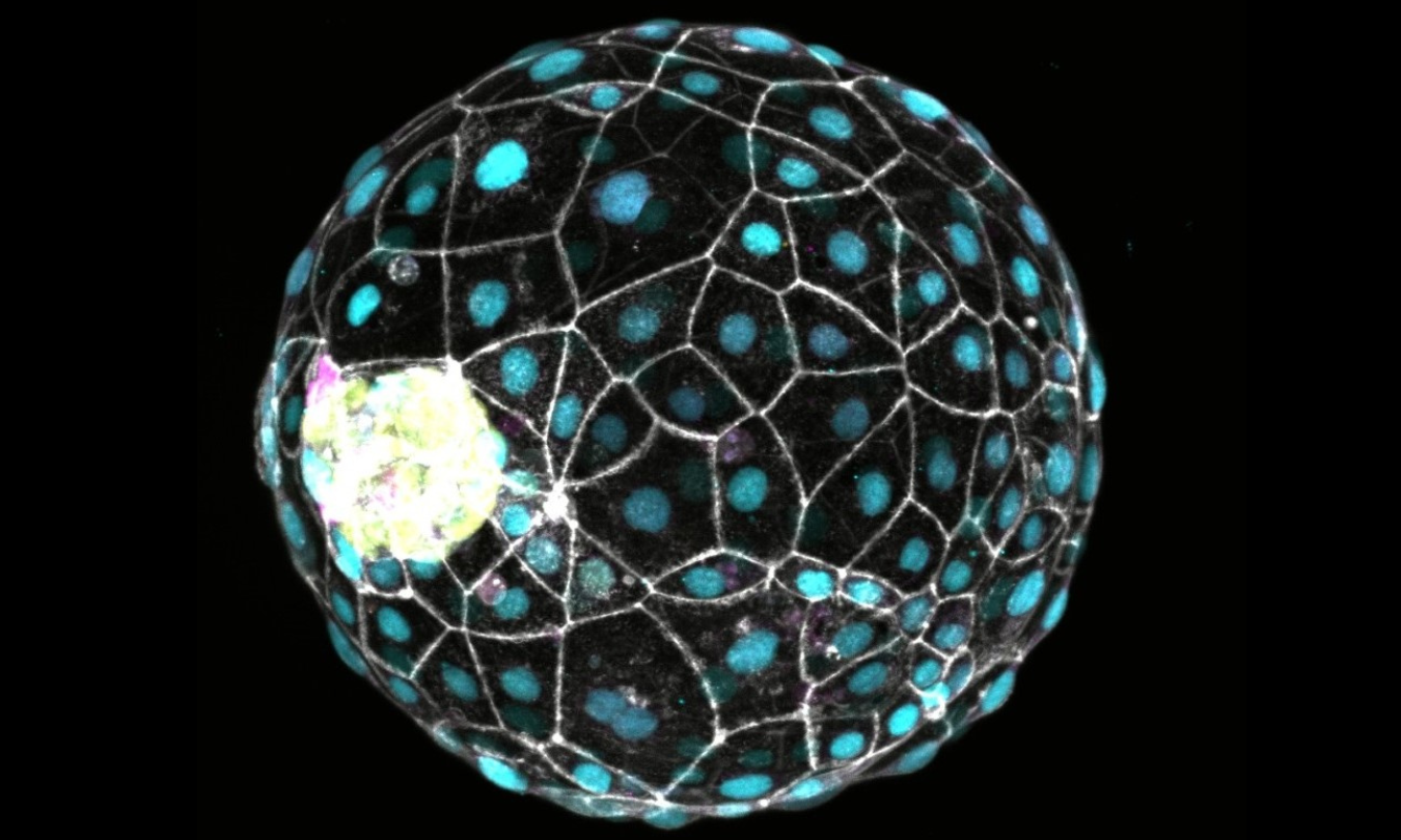 Scientists discover ‘Pause Button’ in human development |ERC Scientists discover ‘Pause Button’ in human development |ERC